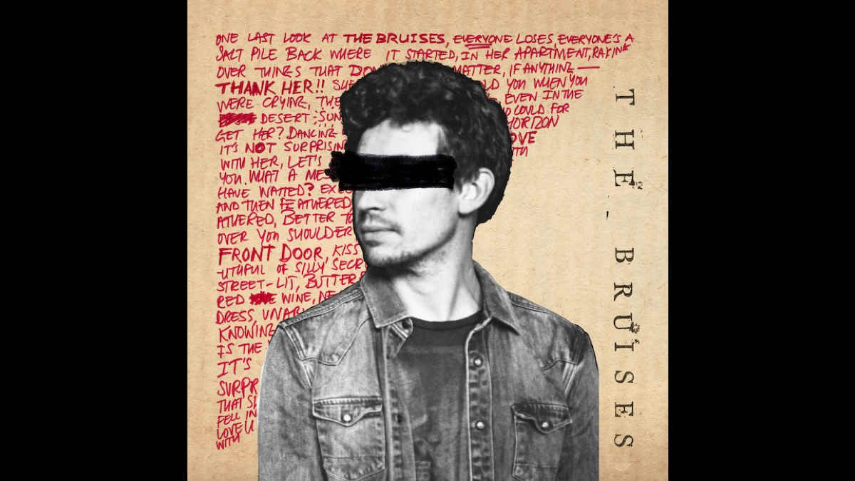 WILLIAM The CONQUEROR – ” The Bruises “ | The Fat Angel Sings